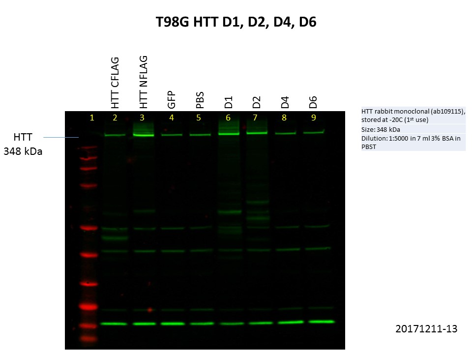 Overexpression of Expanded HTT in Brain Cancer Cell Lines ...