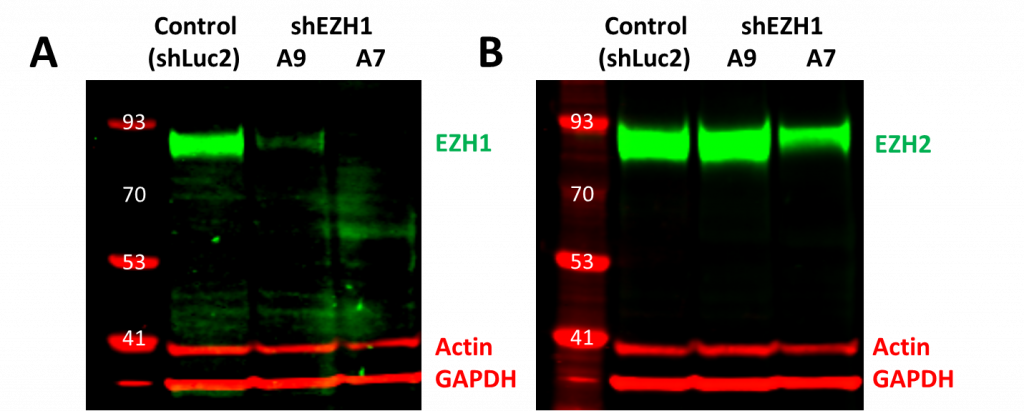 Finally finding an antibody to detect EZH1 protein expression ...