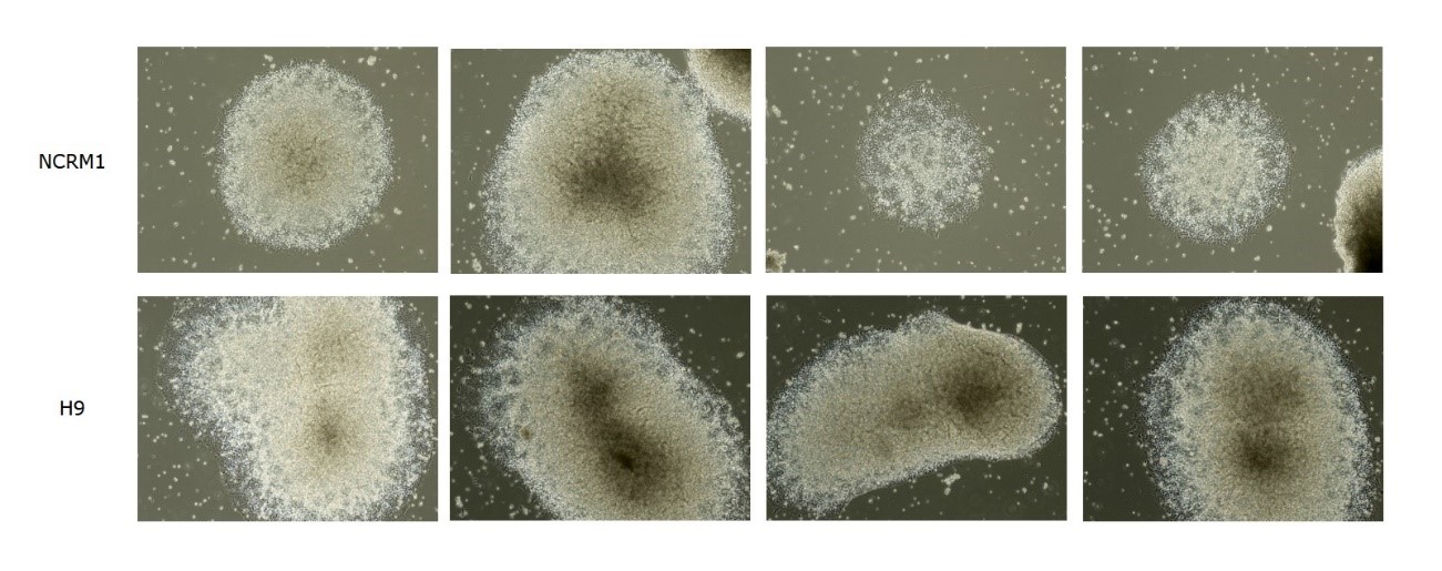 Making neuronal progenitors: The pre-season period for neurons ...