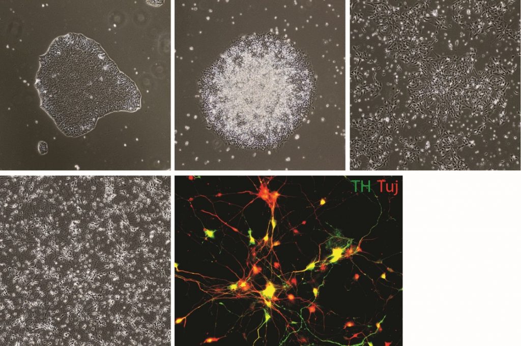 Years and Years… of Dopaminergic neurons – openlabnotebooks.org